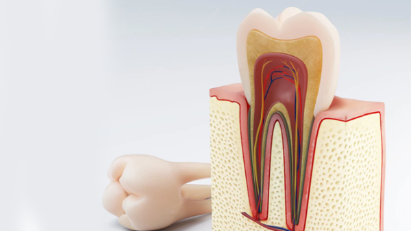 Root Canal Treatment Oakville | Root Canal Therapy